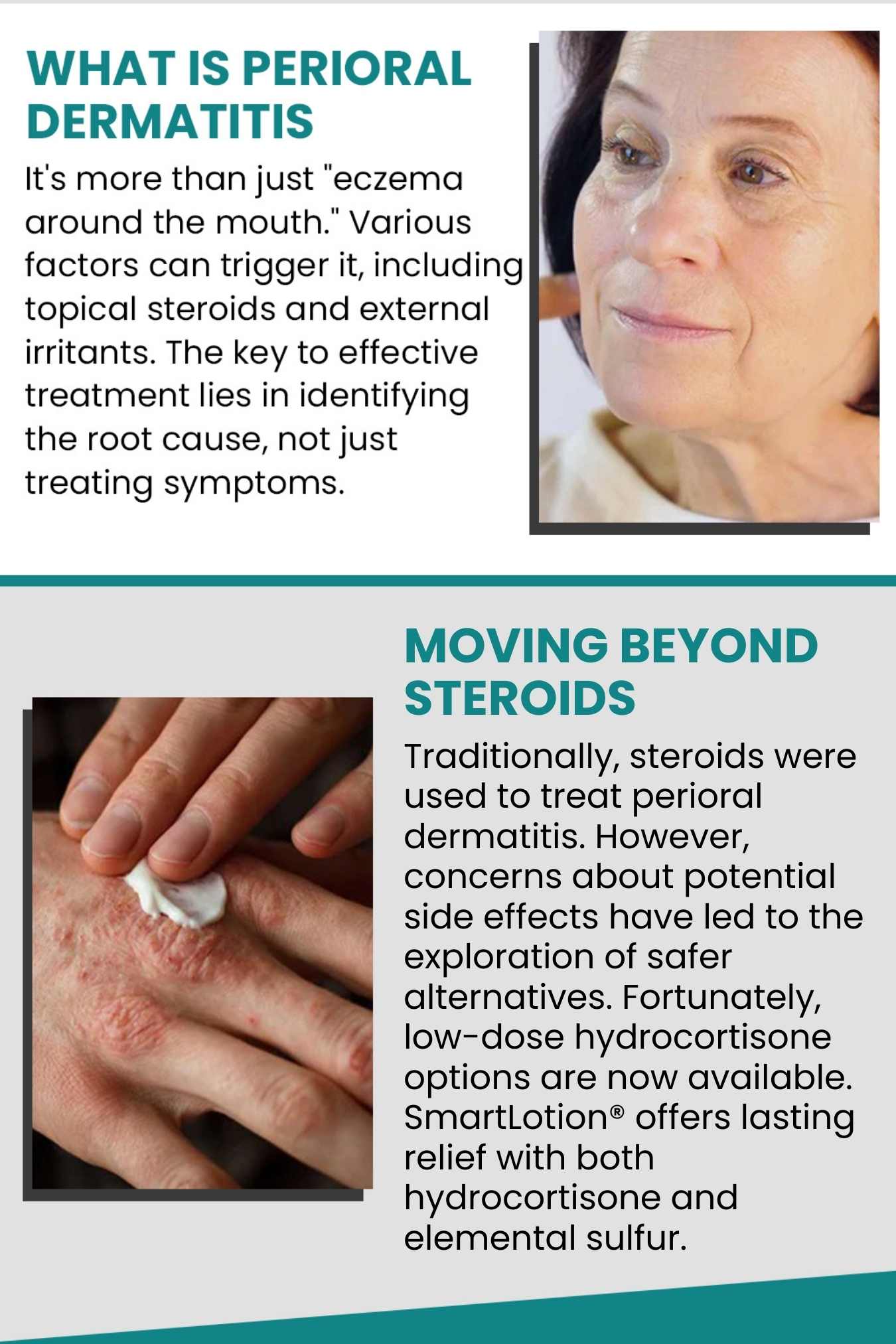 Harlan MD: Breaking Through: Modern Solutions for Perioral Dermatitis ...