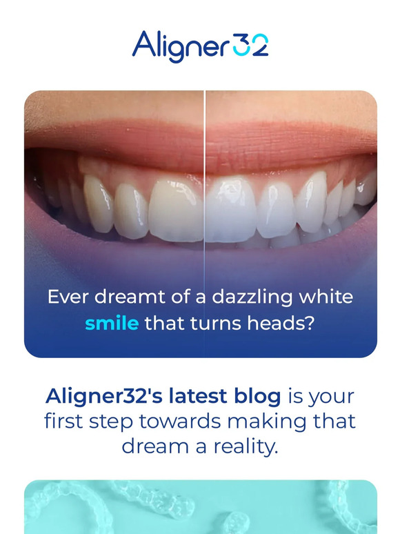 Aligner: Get Your Brightest Smile Ever with Aligner32's Ultimate ...