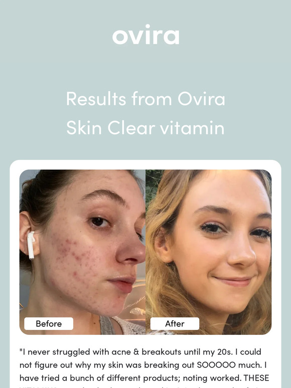 Ovira: Are these fake — —? | Milled