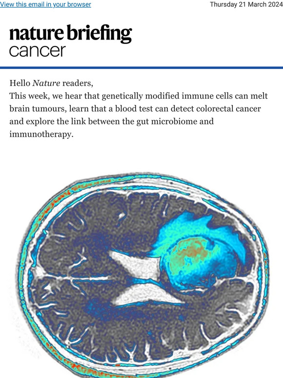 Nature: CAR T shrinks brain tumours — but not for long | Milled