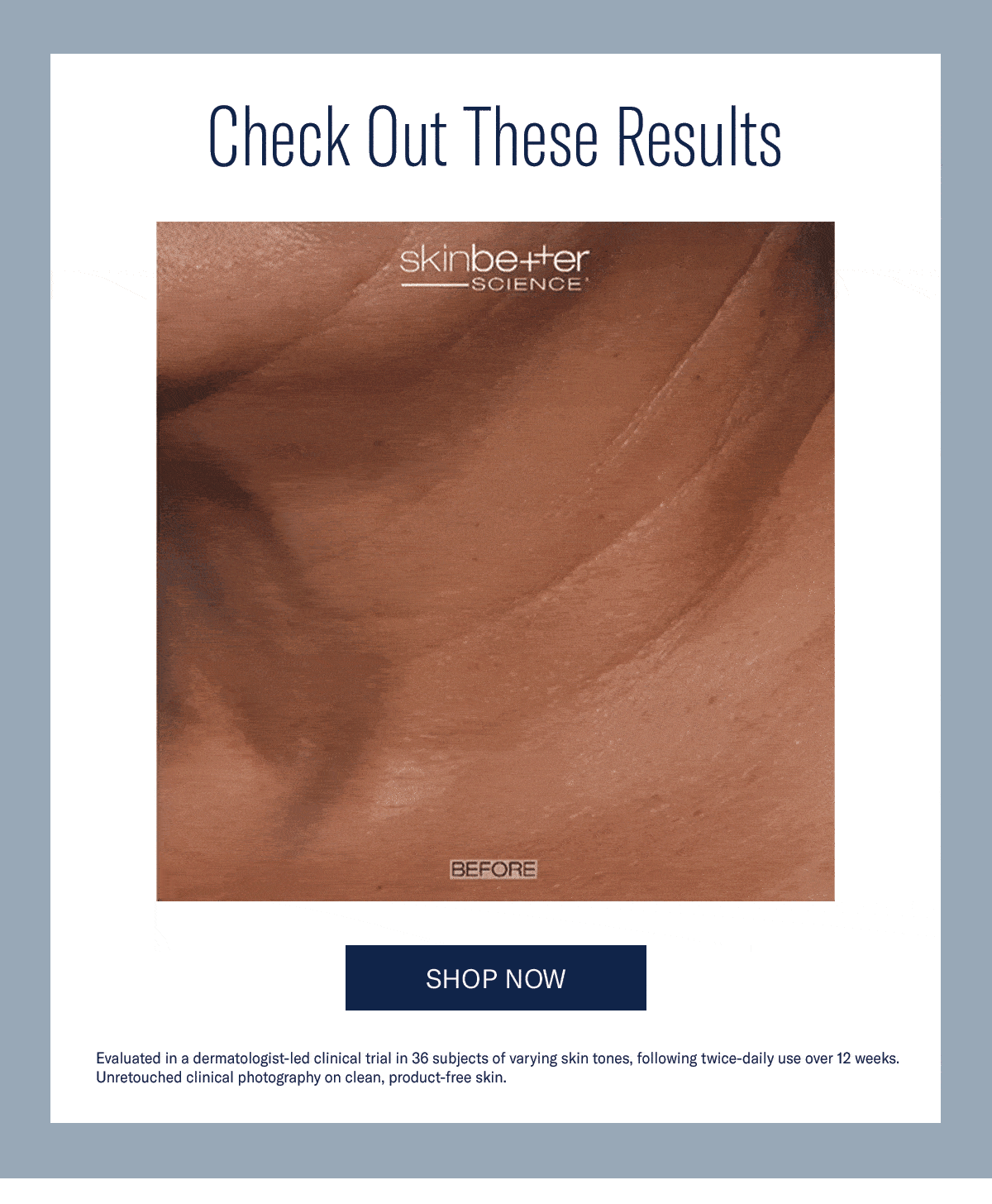 SkinBetter Science: 5 Reasons to Try Techno Neck Perfecting Cream | Milled