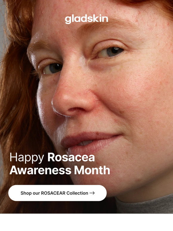 Gladskin: This Rosacea Awareness Month, we’re celebrating you 💕 | Milled