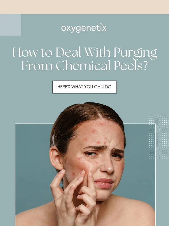 Oxygenetix: 10 ways on how to overcome Post-Peel Purging | Milled