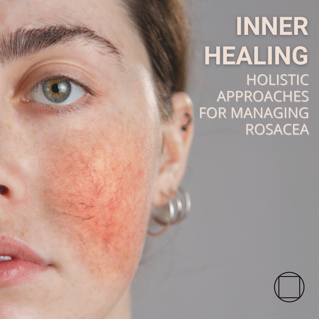 Truth Treatments: Understanding Rosacea: Science, Strategies, and Self ...