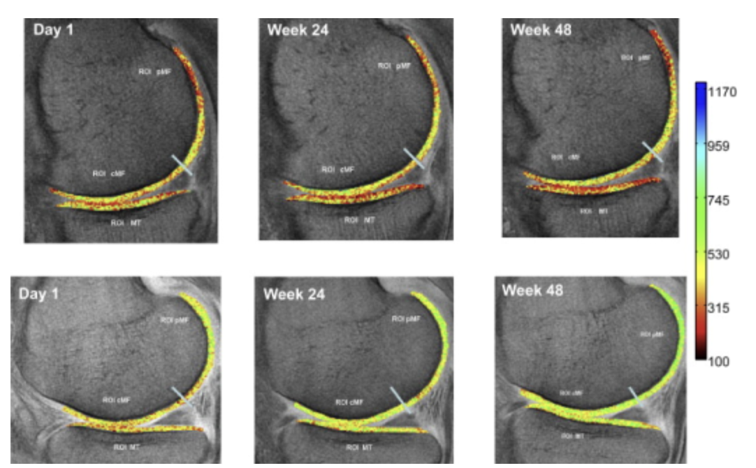 Healthy Back Institute: This Grows New Joint Cartilage | Milled