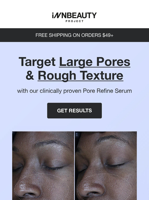 InnBeauty Project: Target Large Pores & Rough Texture | Milled