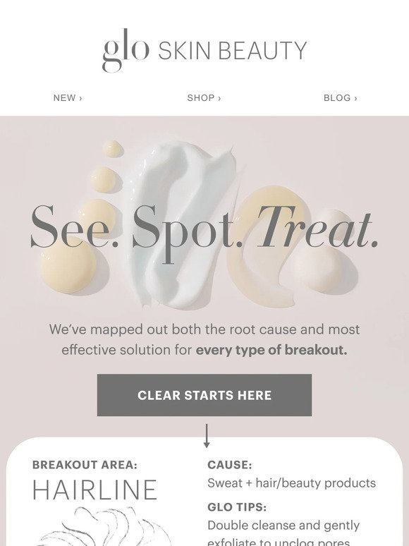 Glo Skin Beauty: The cheat sheet on why you’re breaking out | Milled