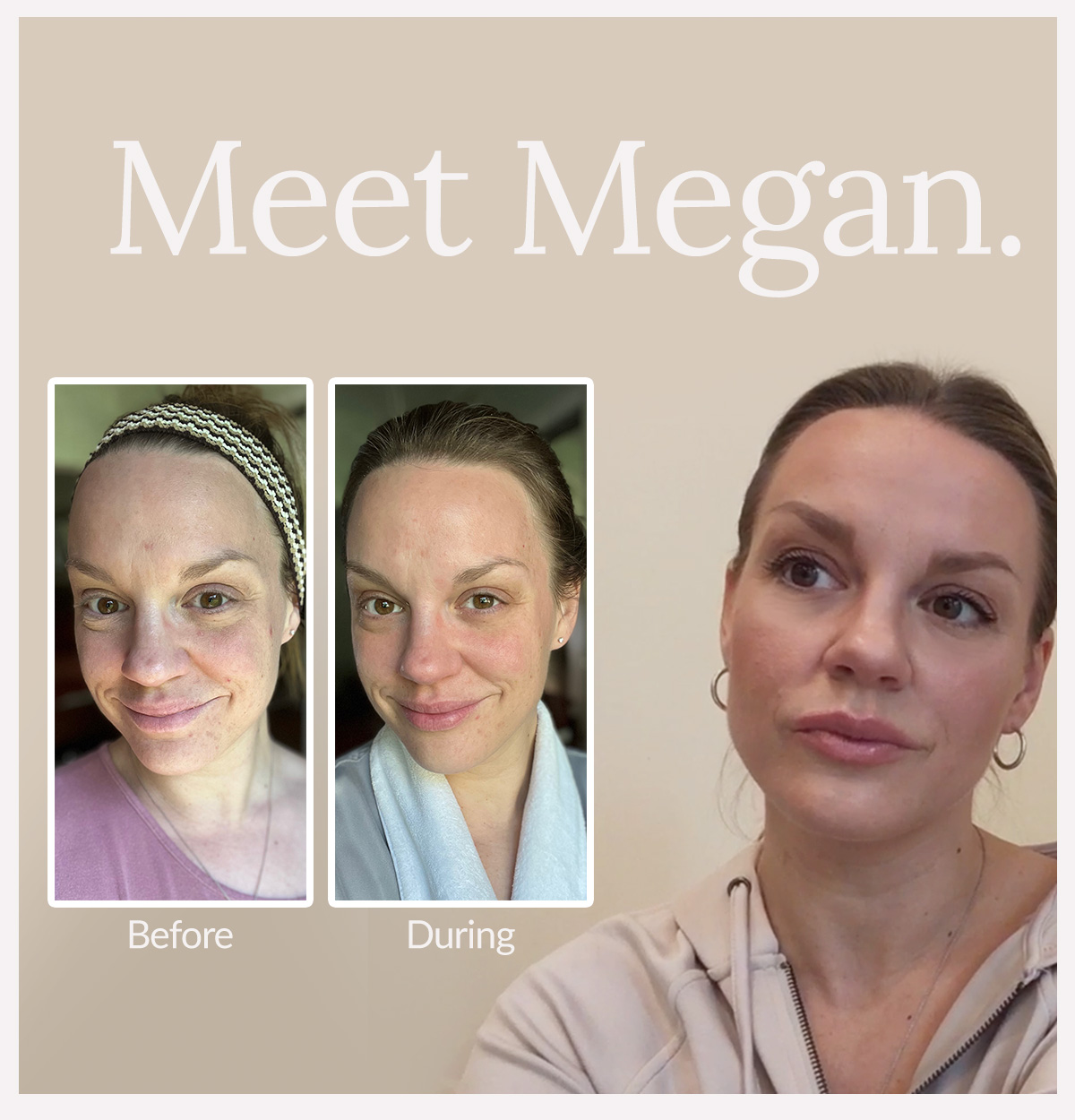 Bambu Earth: Skin Stories: Meet Megan | Milled