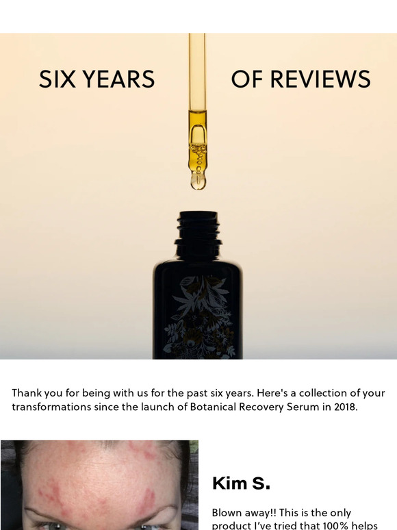 Loa Skin: Six years of skin transformations | Milled