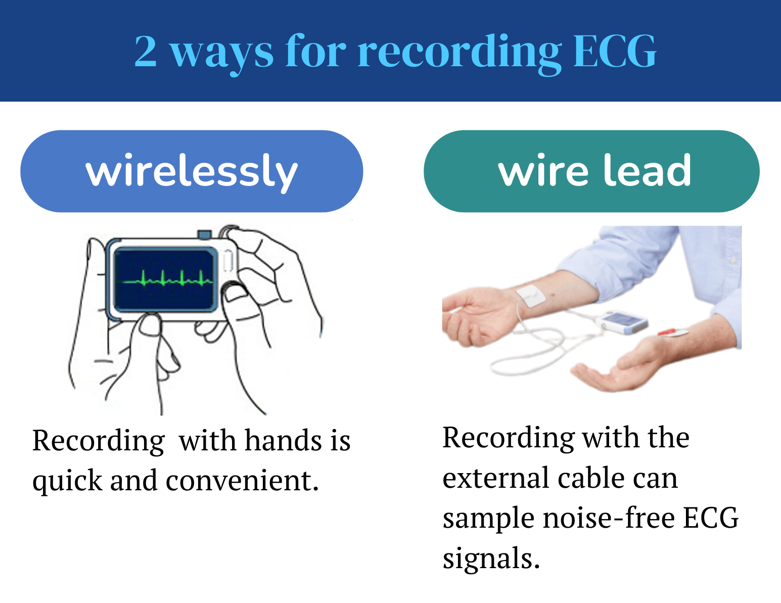 Viatom Technology Co., Ltd.: 50% off Home ECG 🧡AI-ECG Analysis ...