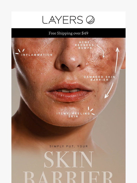 Layers: How to repair a damaged skin barrier | Milled
