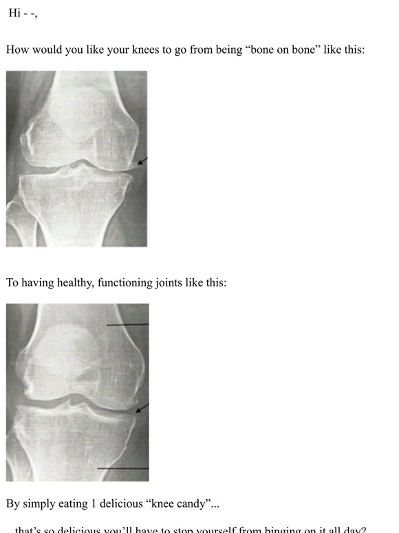 Healthy Holistic Living: New “Knee Candy” Rejuvenates Stiff, Achy ...