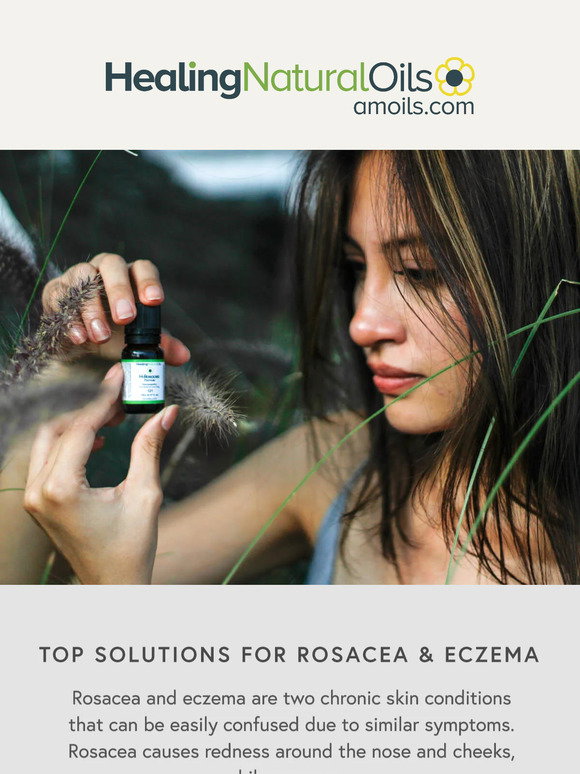 Healing Natural Oils: Top Solutions for Rosacea & Eczema | Milled