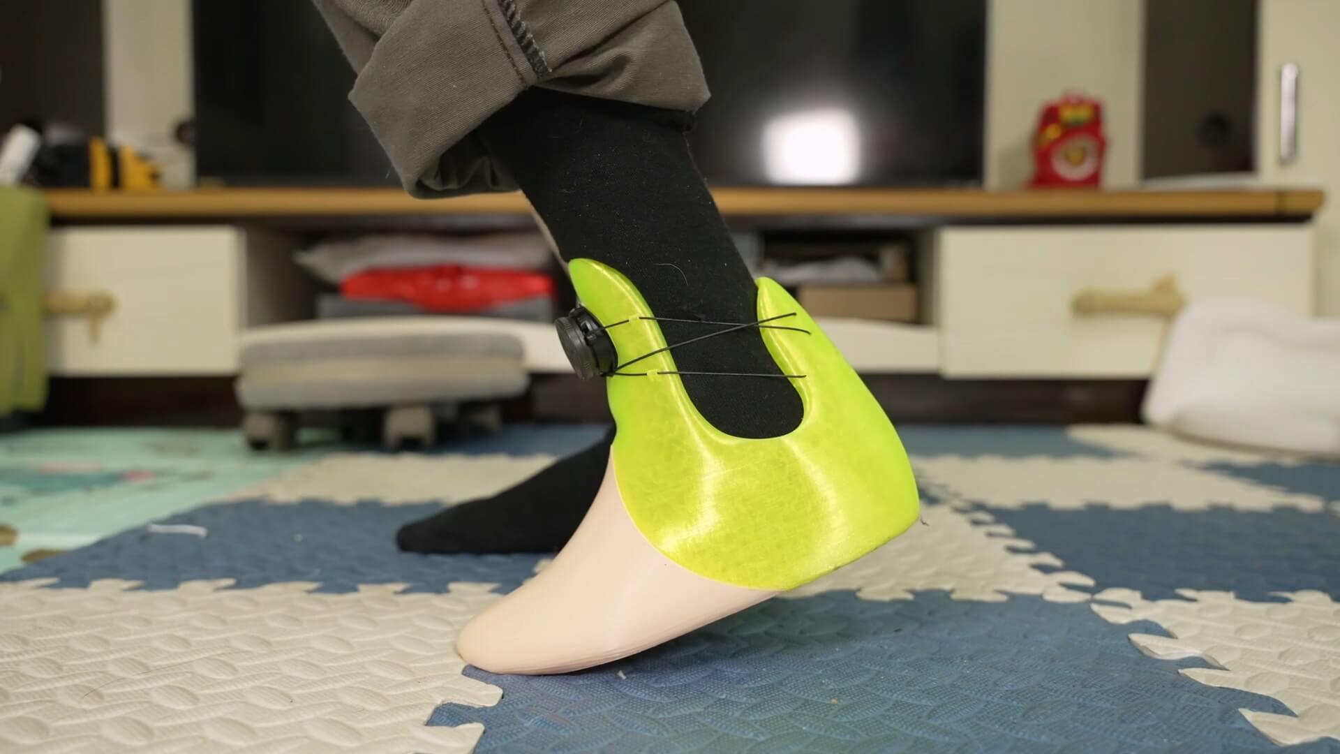 Revopoint: Revopoint UGC | Creating Custom Prosthetics with 3D Scanning ...