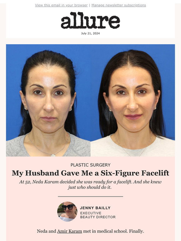 Allure: My Husband Gave Me a Facelift—See the Before and Afters | Milled