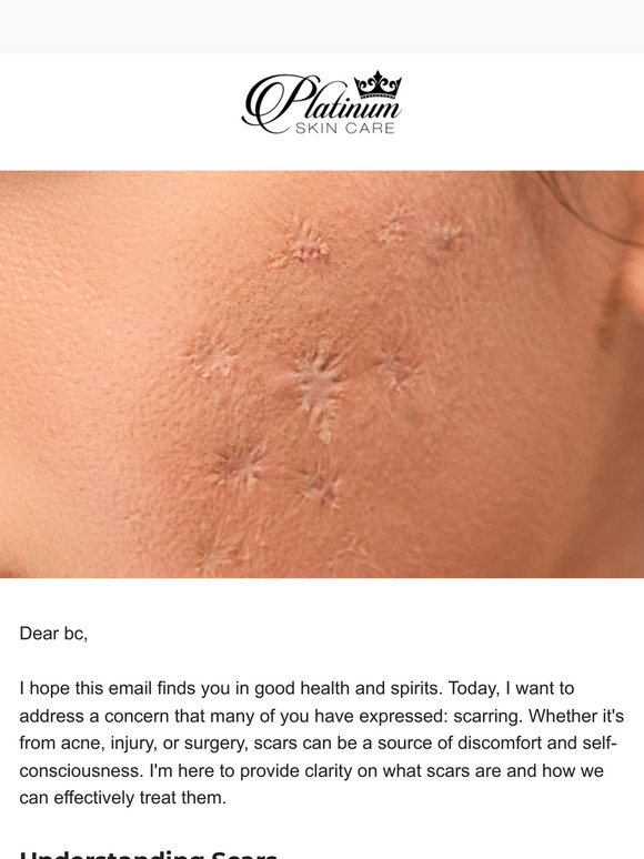 Platinum Skin Care: Comprehensive Guide to Scar Treatment - Part 1 | Milled