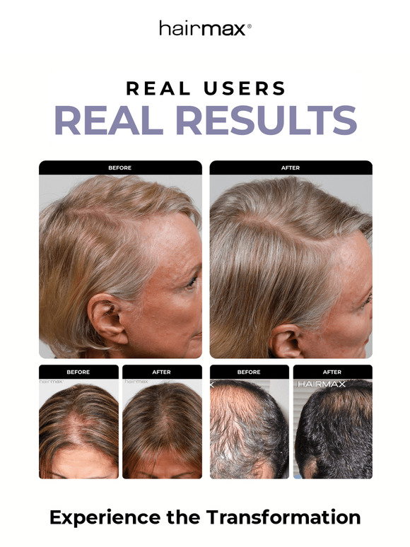 Hairmax: Make Your Dream Hair a Reality | Milled