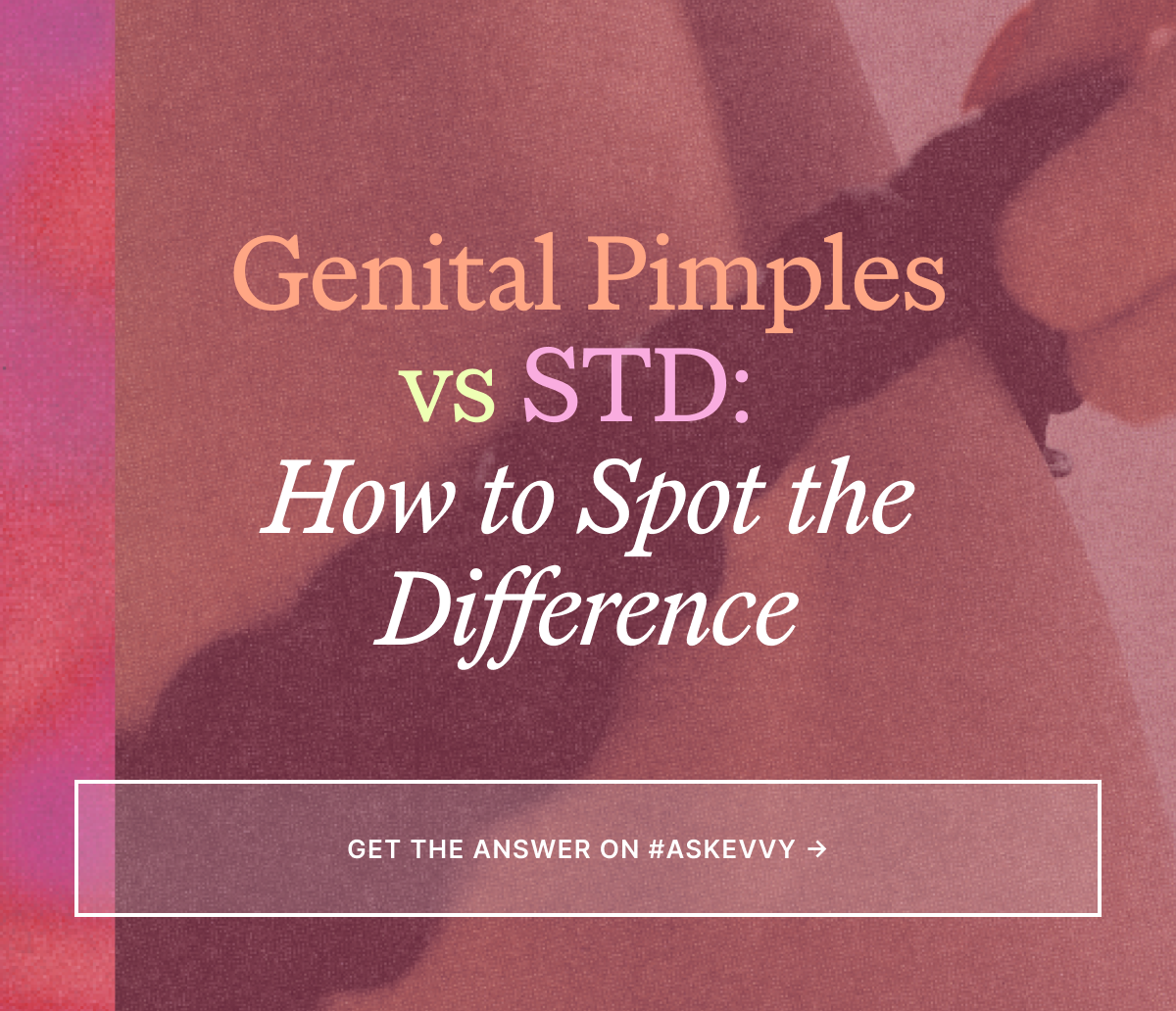 Evvy: Genital Pimples vs STD: How to Spot the Difference | Milled