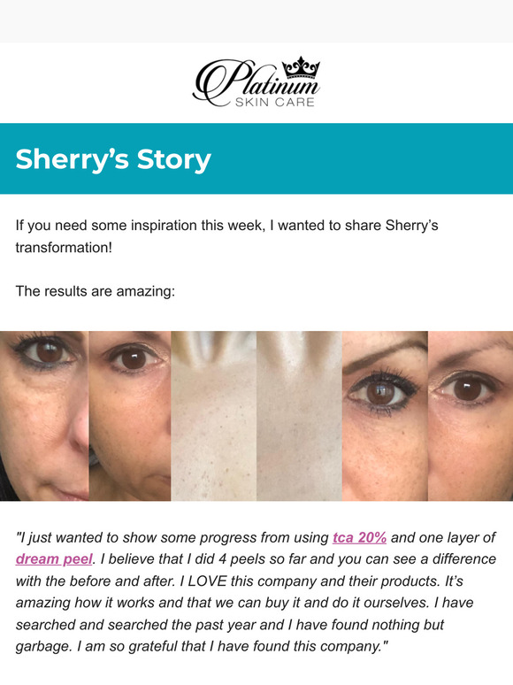 Platinum Skin Care: Check out Sherry’s Transformation | Milled