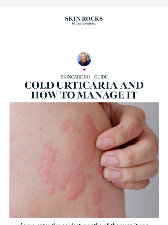 Skin Rocks: Exclusive: Nicolas Travis Talks Allies of Skin & More | Milled