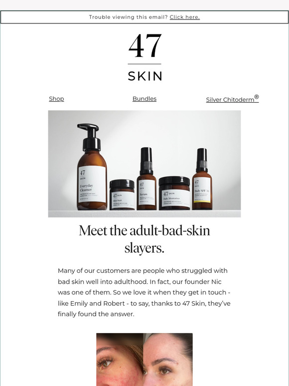 47 Skin: Bye bye, bad (adult) skin 👋 | Milled