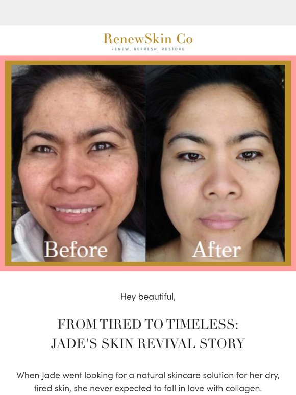 TAUT: From Tired to Timeless: Jade's Skin Transformation | Milled
