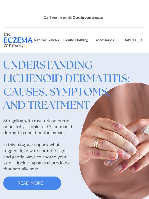 The Eczema Company: Itchy Purple Bumps on your Skin? | Milled