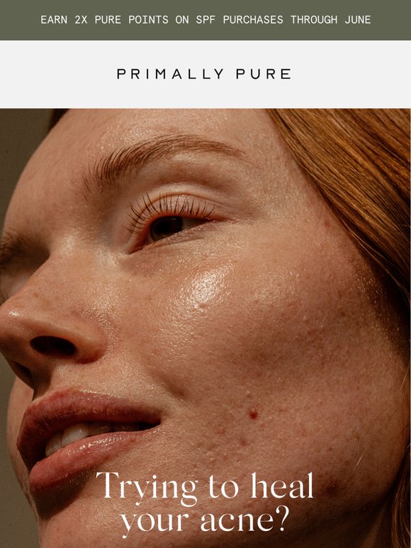 Primally Pure: How to actually heal acne (it’s not what your derm said ...