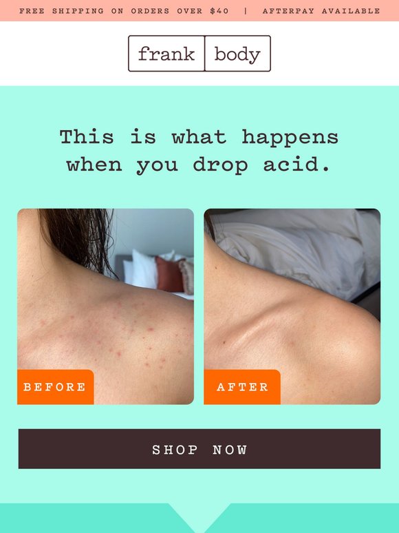 Frank Body: Acid receipts: The proof it works. | Milled